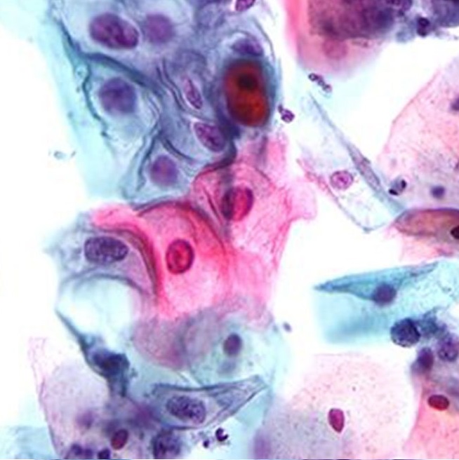 Ematossilina di Harris - Papanicolaou - Pap1A | 01HEMHP500 | Histoline